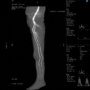 Vascular Imaging (CT Angiography & Doppler Ultrasound) – NIA Diagnostic ...